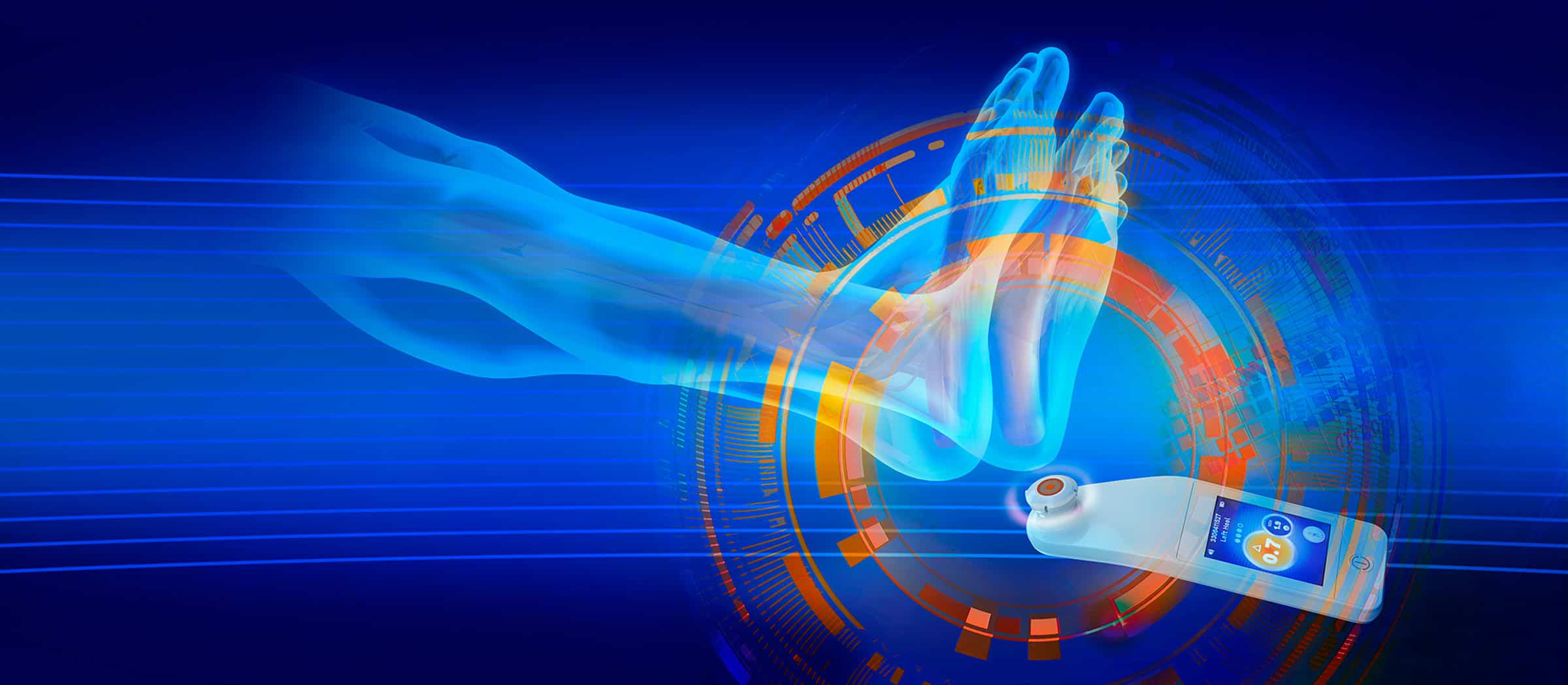 Pressure Ulcer Prevention - PU Risk | Provizio SEM Scanner