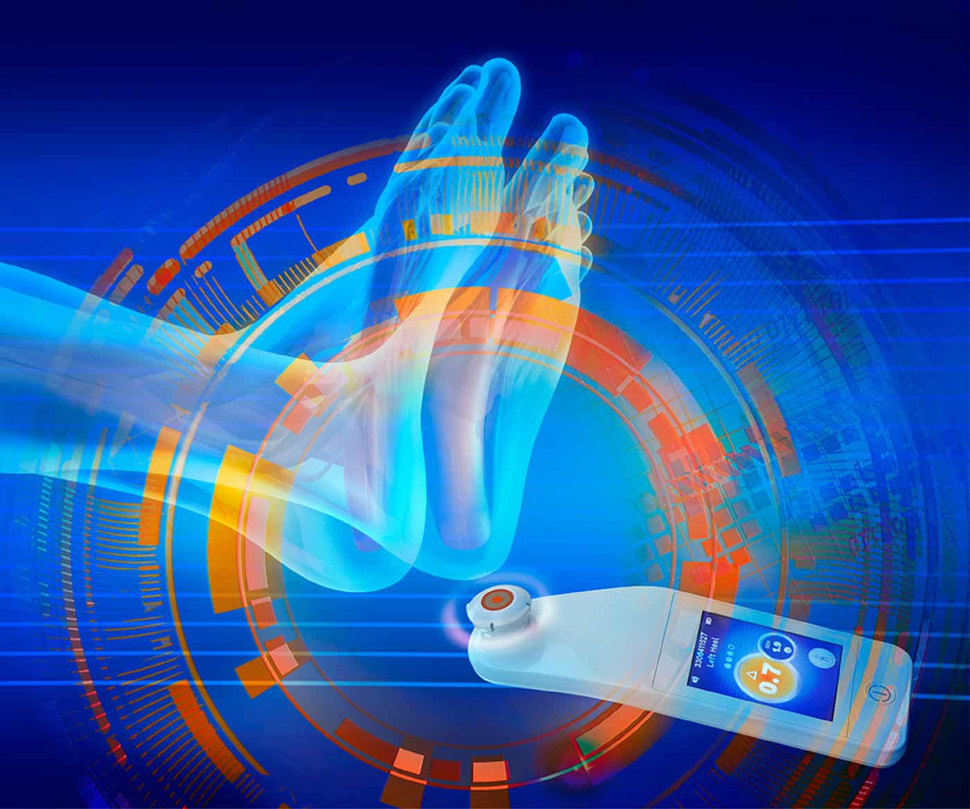 Pressure Ulcer Prevention - PU Risk | Provizio SEM Scanner