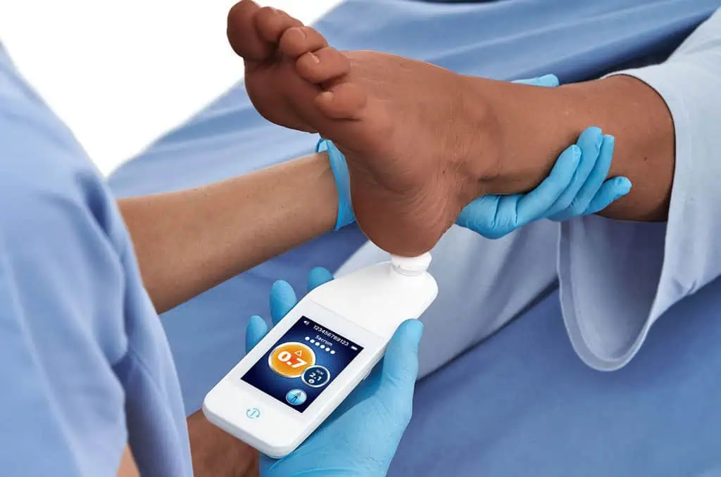 Provizio® SEM Scanner - NHSSC Pressure Area Tower 5 Framework