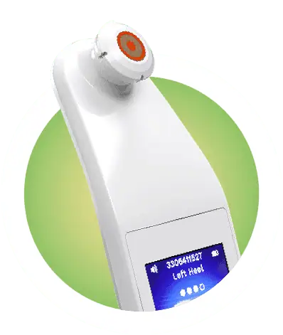 Early Detection of Pressure Injuries | Provizio® SEM Scanner