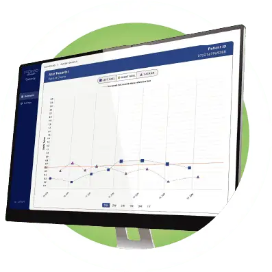 Early Detection of Pressure Injuries | Provizio® SEM Scanner