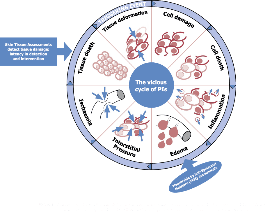 Detect, Treat & Prevent Pressure Injuries | SEM Academy
