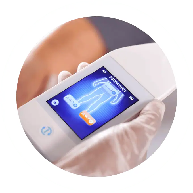 Early Detection of Pressure Injuries | Provizio® SEM Scanner